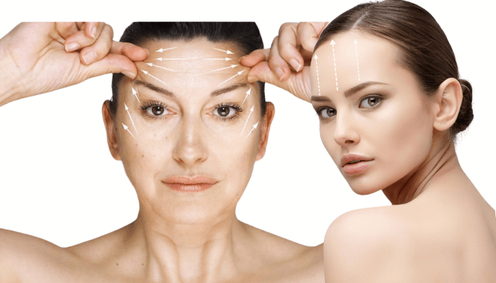 OPERASI BROW LIFT - Agent OP Thailand